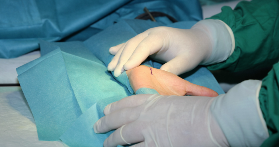 Hand Doctor in Knoxville, TN | Knoxville Hand Surgeons